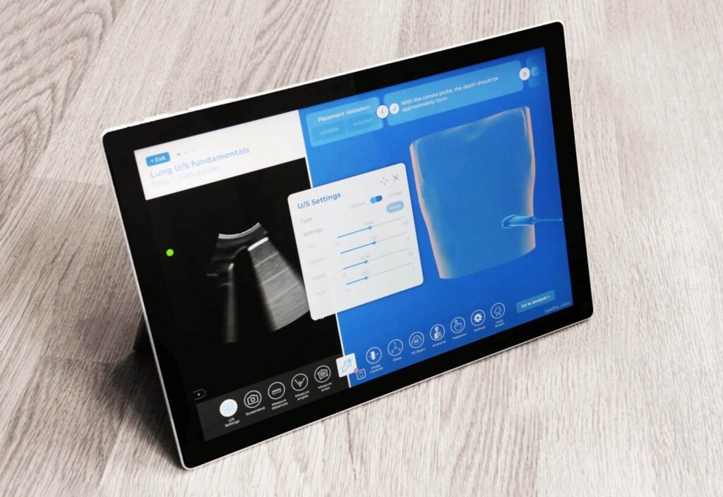 Quelle est la résolution de la vidéo composante ? - GAG01